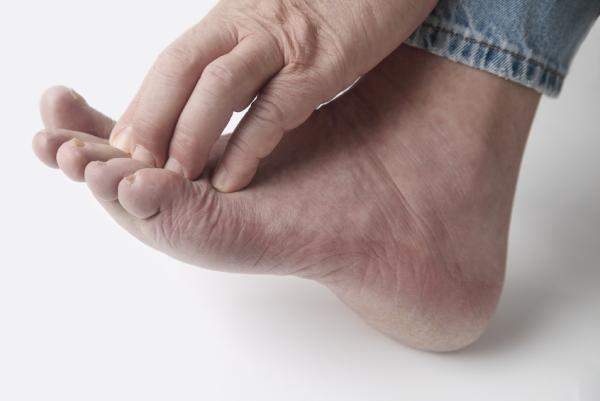 Por qué siento que me arden los pies
