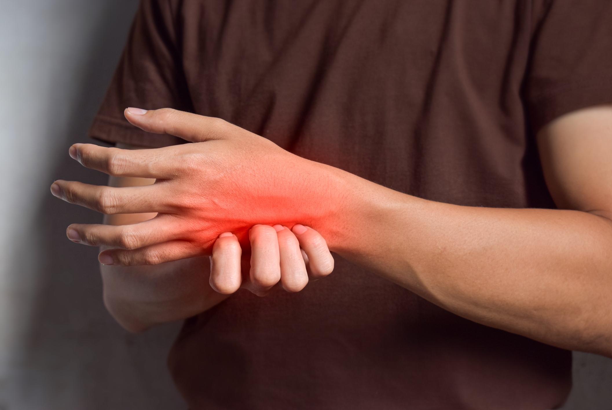 Cómo saber si tengo sarna: síntomas y causas - Conoce todos los ...