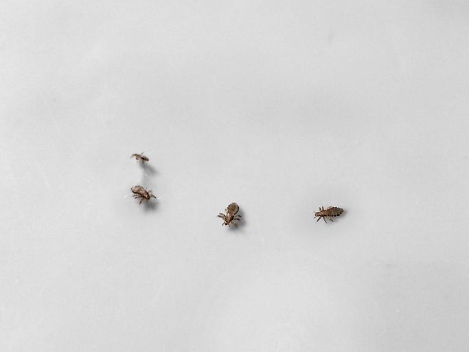 Cómo saber si tengo LADILLAS y cómo eliminarlas - Síntomas y Soluciones