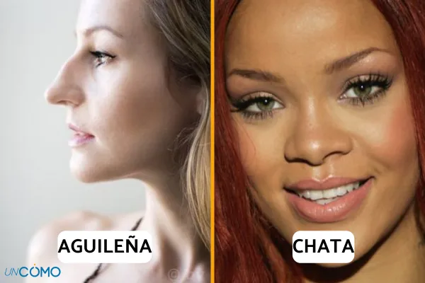 Diferentes Tipos De Formatos De Nariz Tipos De Nariz Para Rinoplastia
