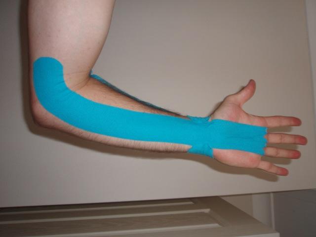 Por qué me duele el codo