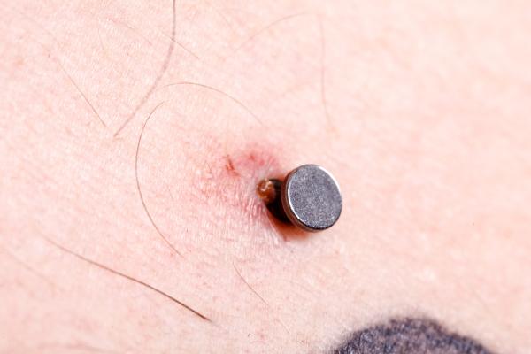 microdermal piercing cara