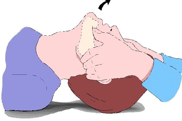 Qué hacer si alguien se desmaya - 9 pasos