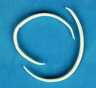 Cómo curar los oxiuros naturalmente - 6 pasos