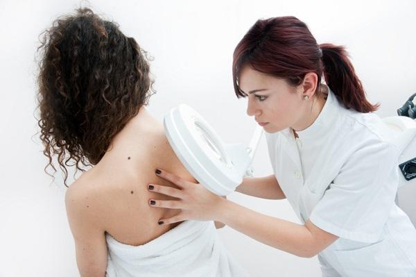 Cómo Eliminar Las Pecas 7 Pasos