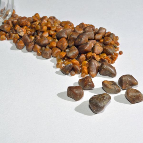 Calculo Biliar Humano Océano Medicina Cursos 100% Online Para