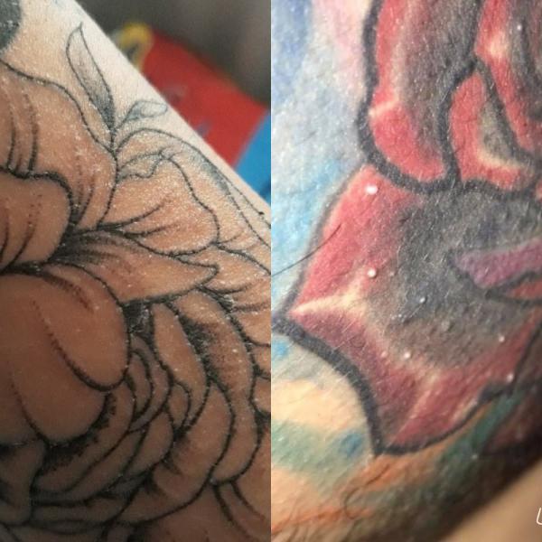 Como Cicatrizar Tattoos Sabes Como Curar Una Quemadura De Láser?